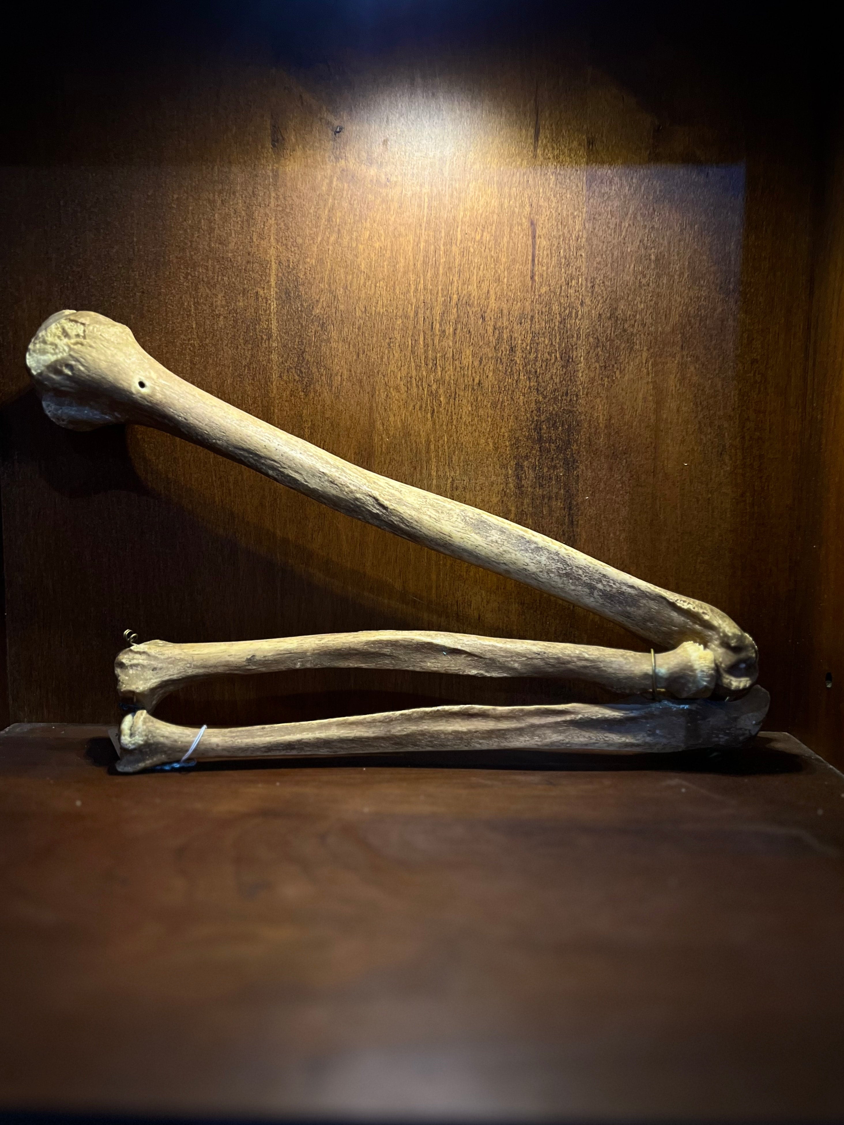 Human Articulated Arm Bones | The Wunderkammer Olde Curiosities Shoppe